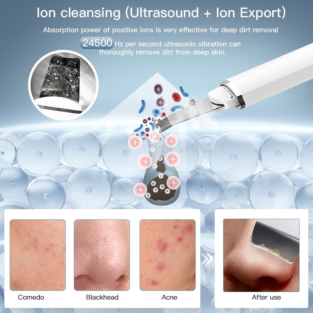 Ultrasonic Skin Scrubber Vibration Face Spatula – LightsBetter